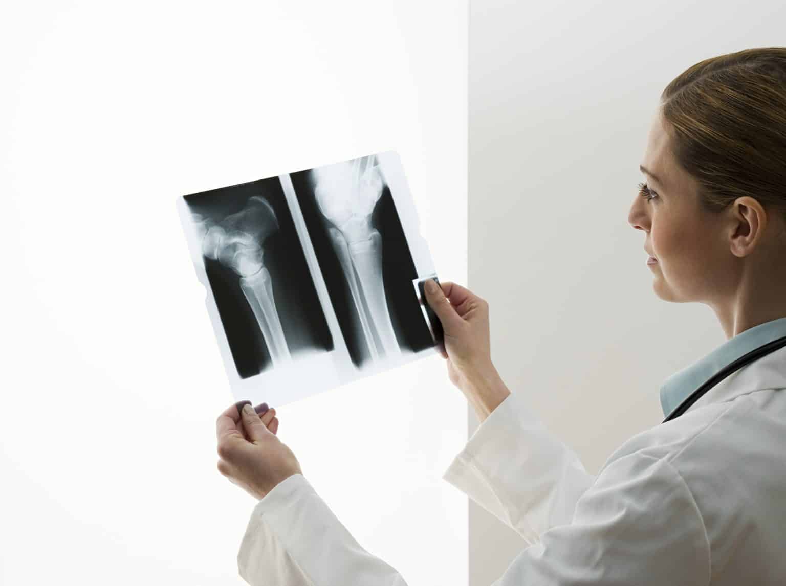 Do I Need a Referral for an X-Ray? Understanding Imaging Requirements - Valence Medical Imaging