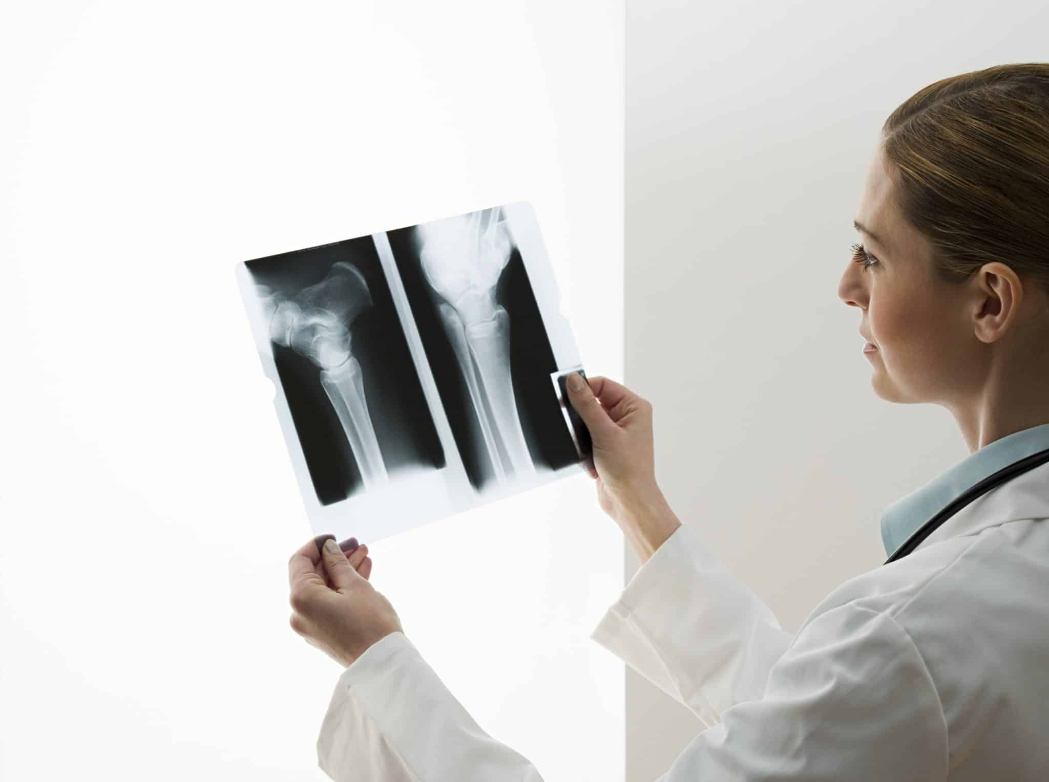 What Is Digital X-Ray? - Advancements in Imaging Technology - Valence ...