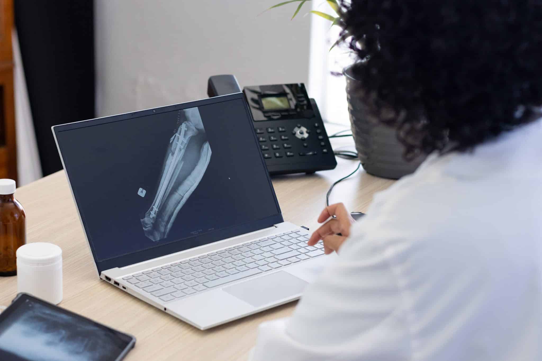 What’s the Difference Between a Bone Scan and an X-Ray? - Choosing the ...