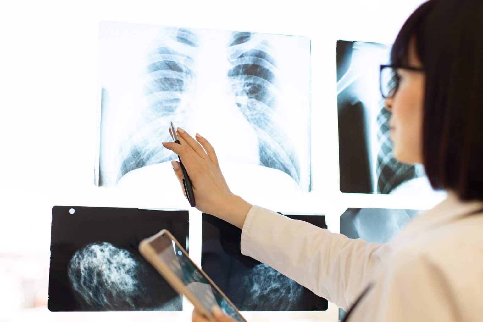 Why Do I Need a Chest X-Ray? - Common Reasons & What It Detects - Valence Medical Imaging