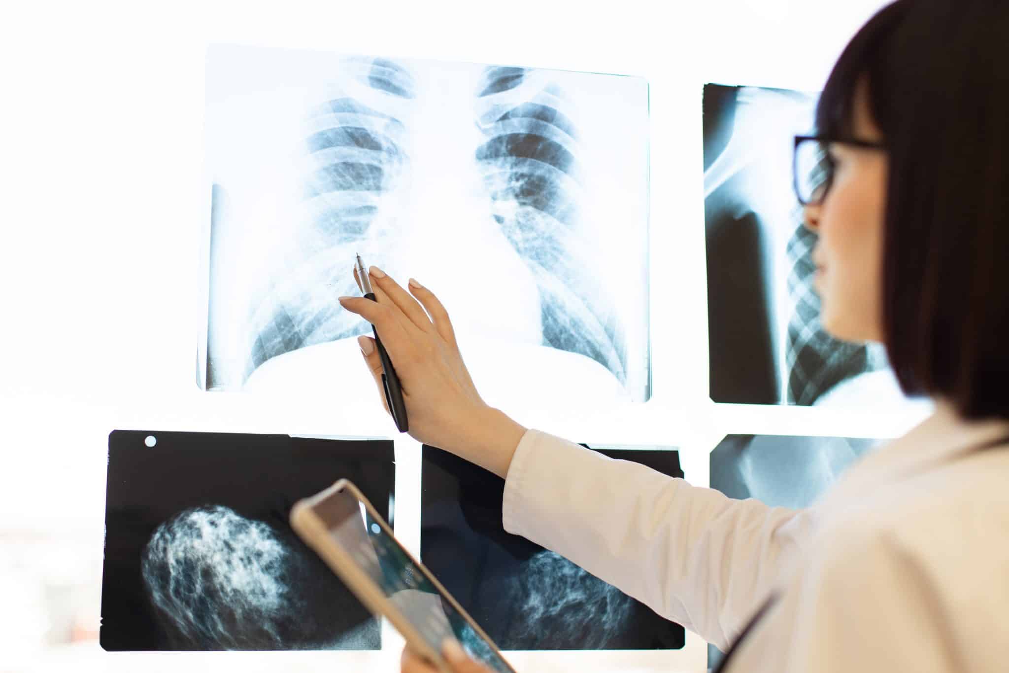 What Are the Different Types of X-Rays? Exploring Imaging Options ...