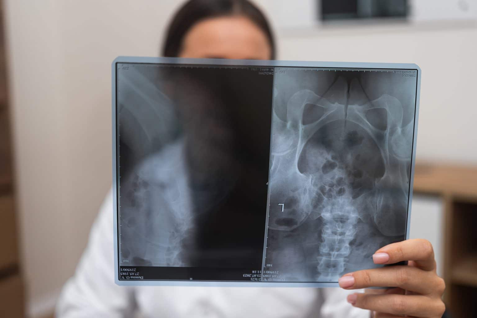 How Should I Prepare for an X-Ray? Tips for a Smooth Imaging Experience - Valence Medical Imaging