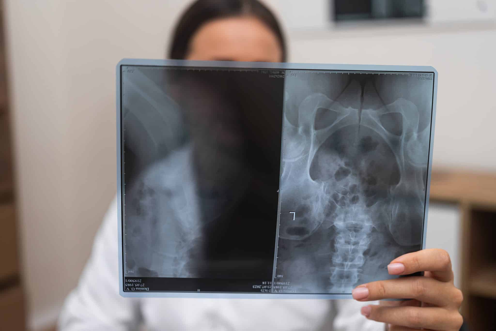 How Should I Prepare for an X-Ray? Tips for a Smooth Imaging Experience - Valence Medical Imaging