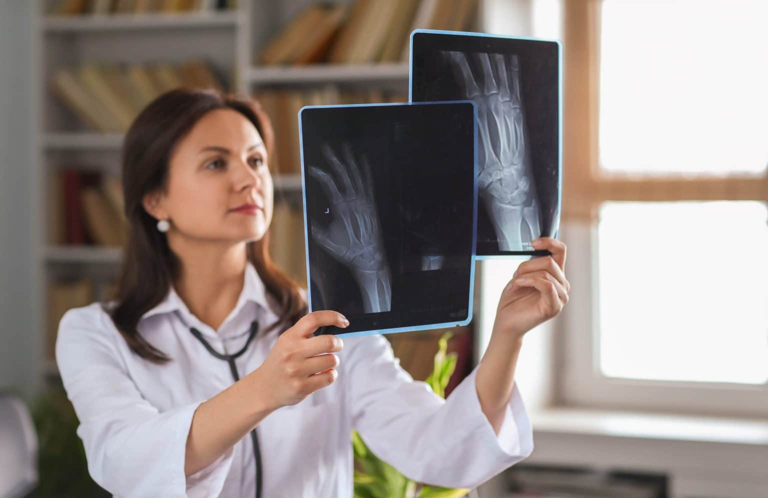Where Can I Get a Walk-In X-Ray in Brampton? Fast, OHIP-Covered Imaging ...